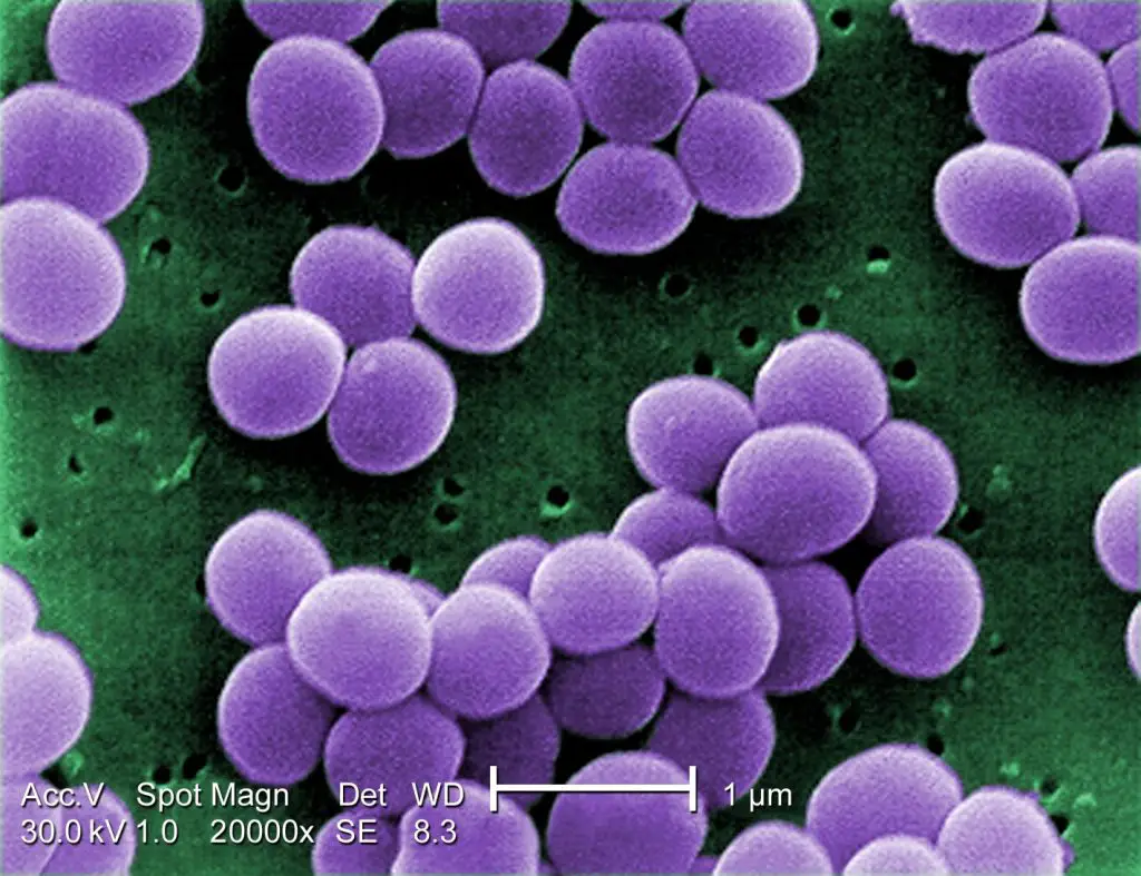 Staphylococcus aureus - Consejos para mi huerto